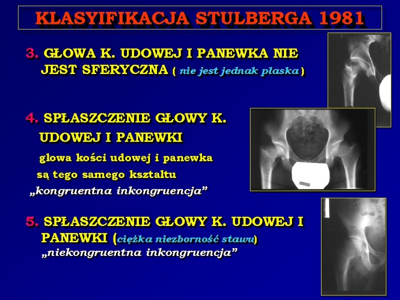 Stulberg_2TA - Ortopedia i Traumatologia